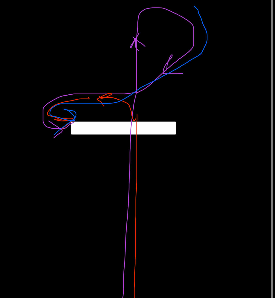 Reverse Teardrop pattern entry - How to yeild? - Activities, Career ...